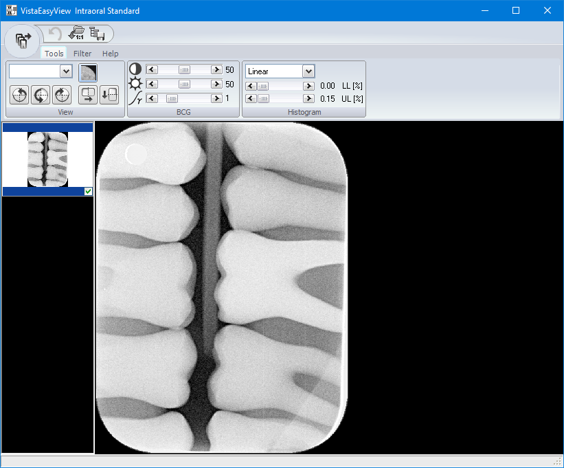 Open Dental Software - Scan X