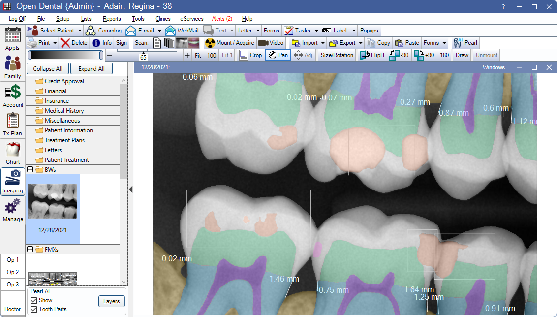 Open Dental Software - Patient Gallery Bridge